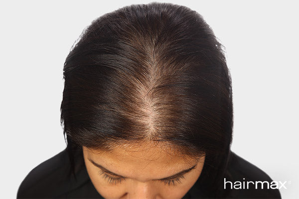 hairmax.com.au – Hairmax Australia